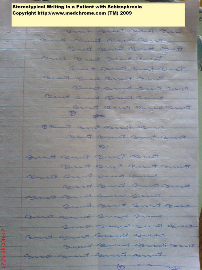 Schizophrenia Major Psychiatric Illness Medchrome Schizophrenia Major Psychiatric Illness Medchrome
